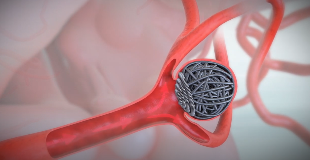 Endostream - Peregrine